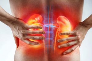 Cólica renal: aprenda a identificar e saiba quando se preocupar ...